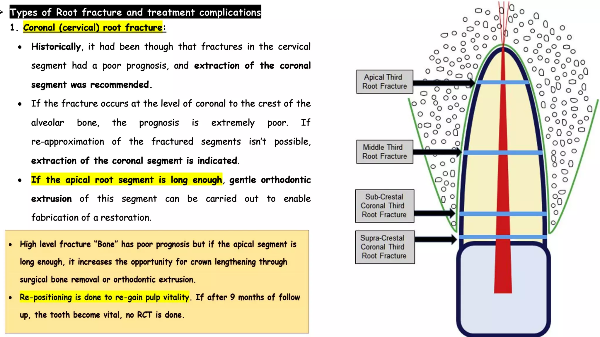 horizontal fracture .pdf