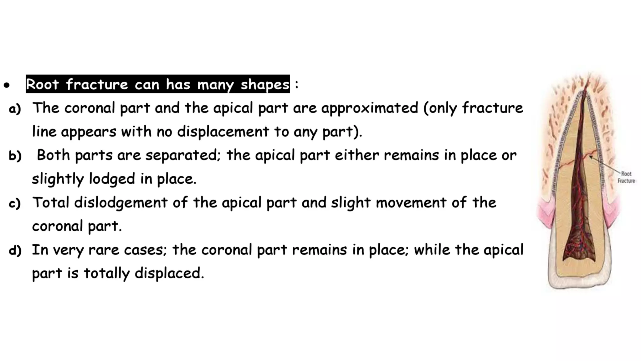 horizontal fracture .pdf