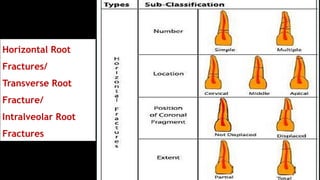 horizontal fracture .pdf