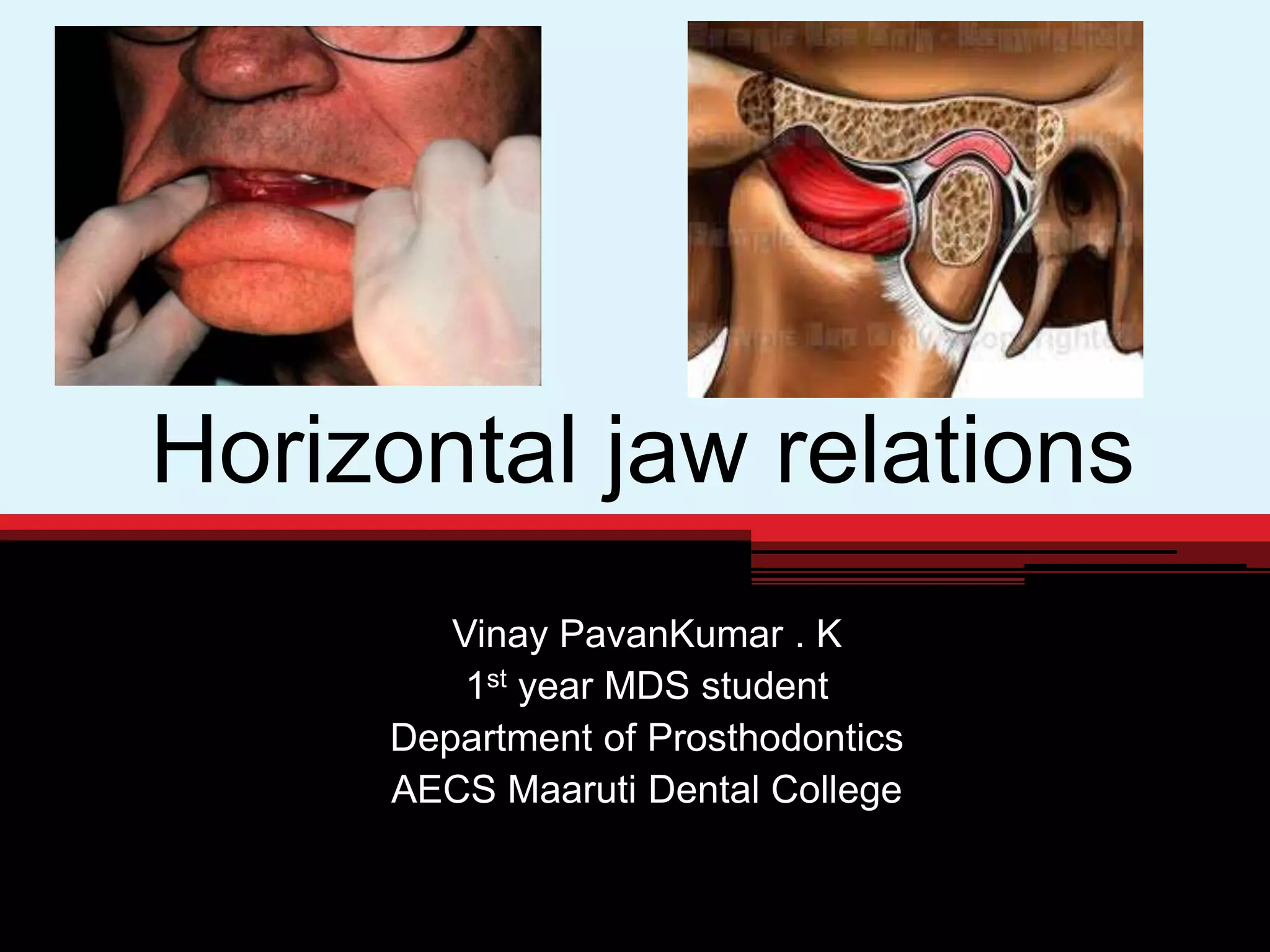 Horizontal jaw relation in complete denture | PPTX