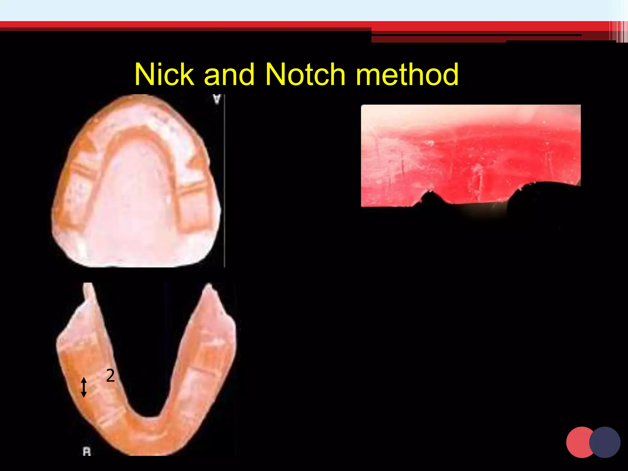 Horizontal jaw relation in complete denture | PPTX