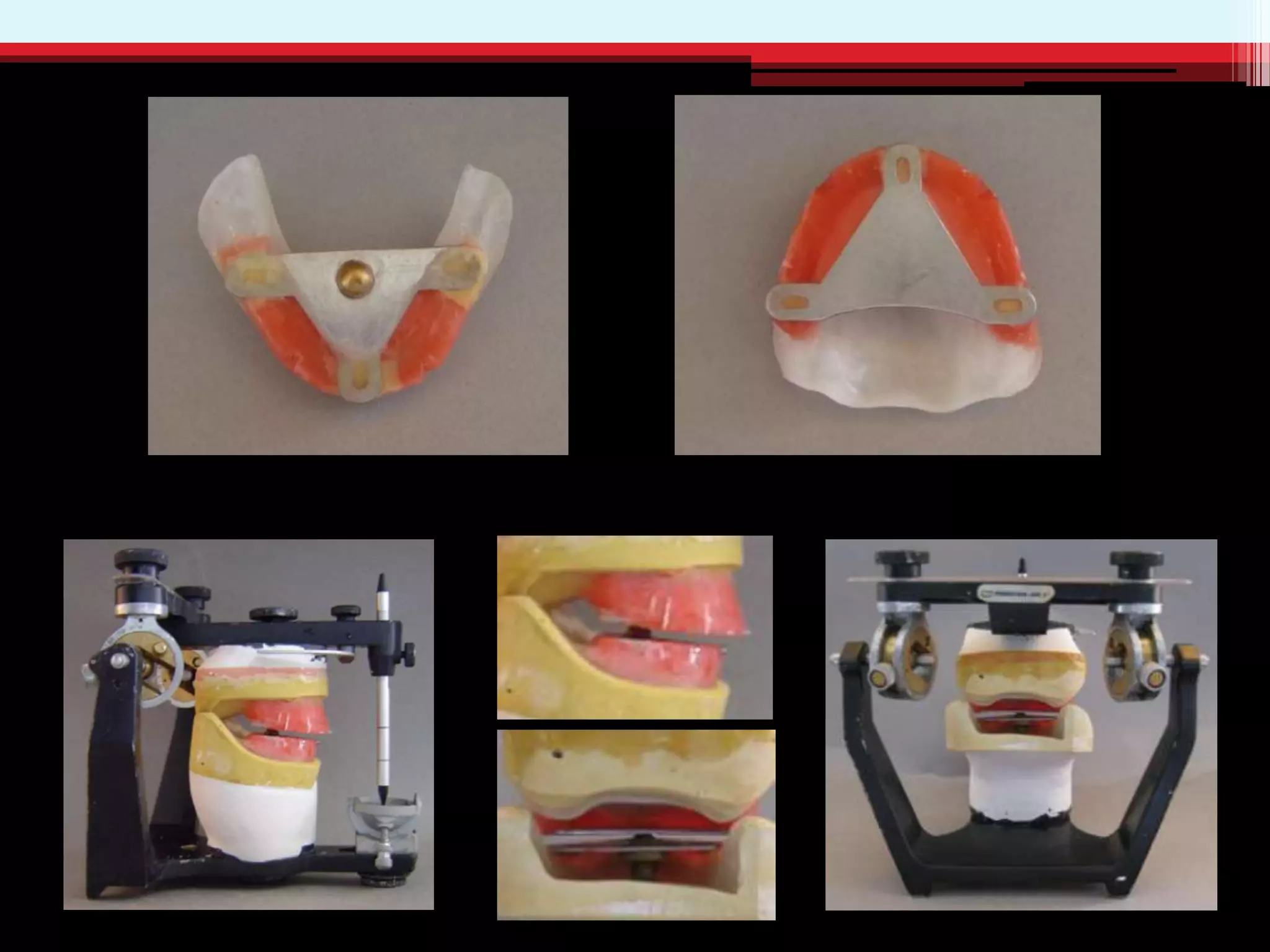 Horizontal jaw relation in complete denture | PPTX
