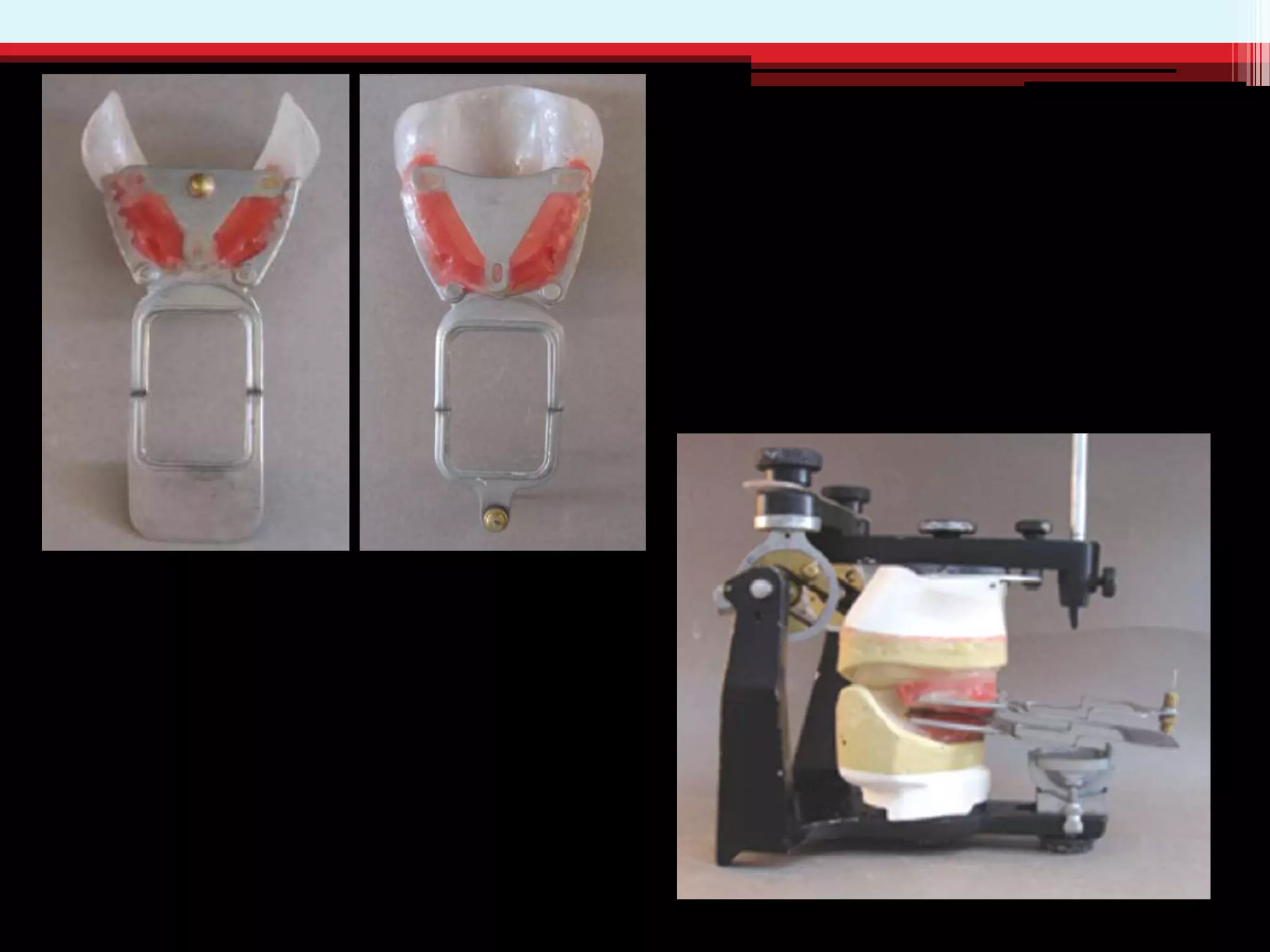 Horizontal jaw relation in complete denture | PPTX