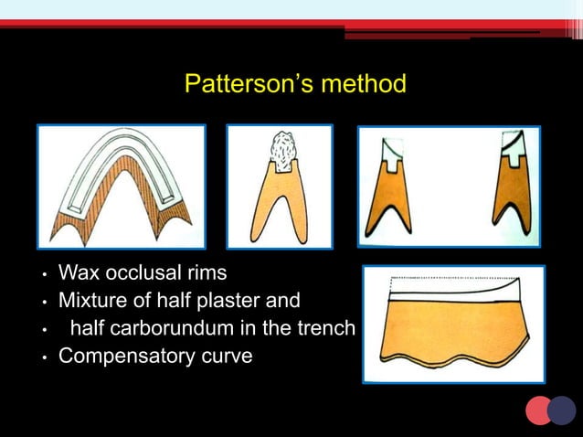 Horizontal jaw relation in complete denture | PPTX | Dental Health ...
