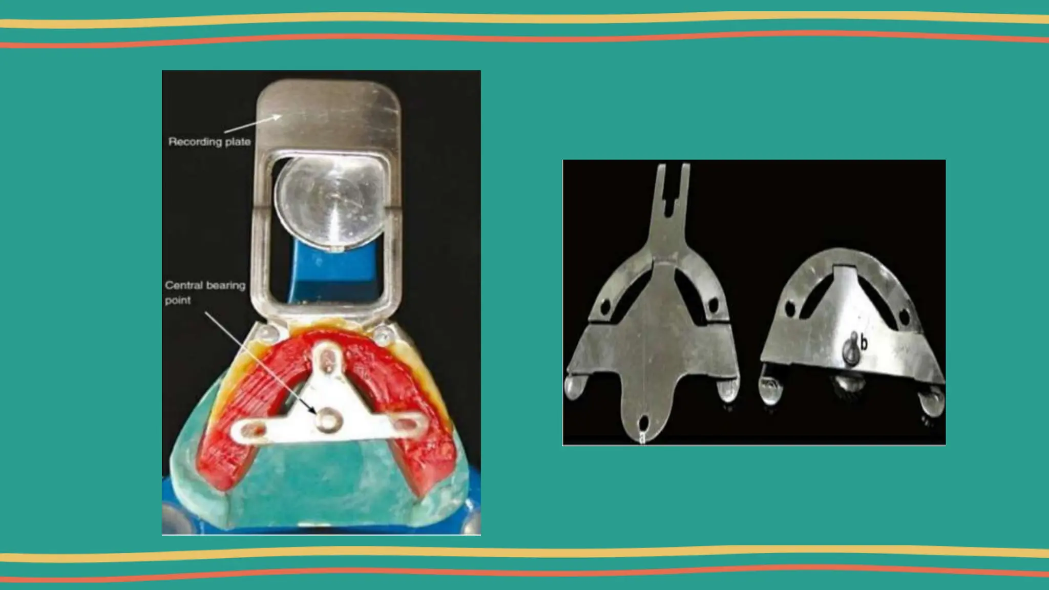HORIZONTAL JAW RELATION - prosthodontics | PPTX
