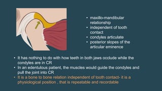 HORIZONTAL JAW RELATION - prosthodontics | PPTX
