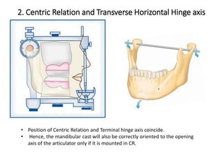Horizontal jaw relation | PPTX