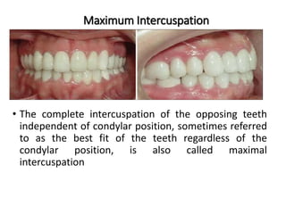 Horizontal jaw relation | PPTX