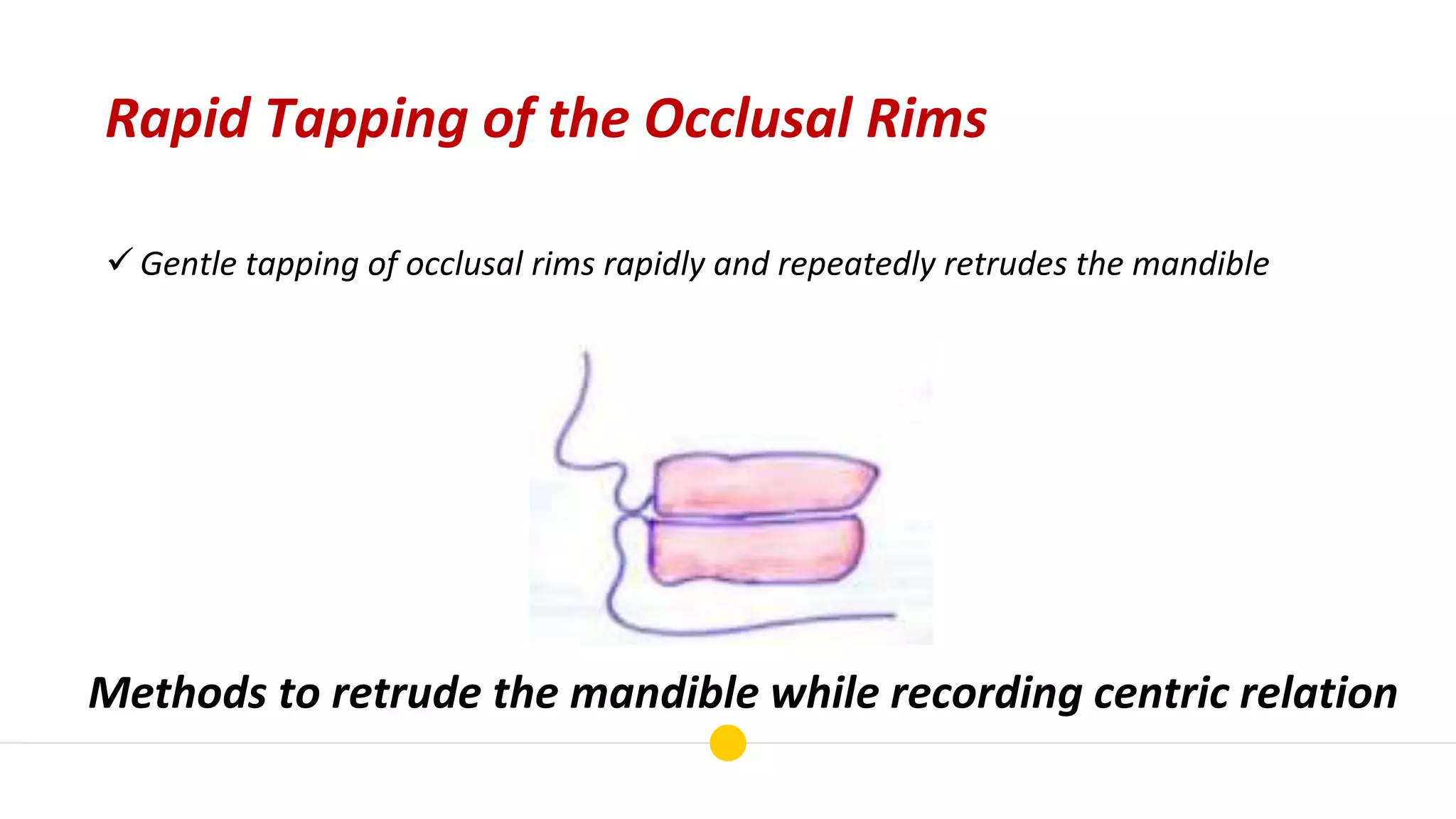 horizontal jaw relation.pptx