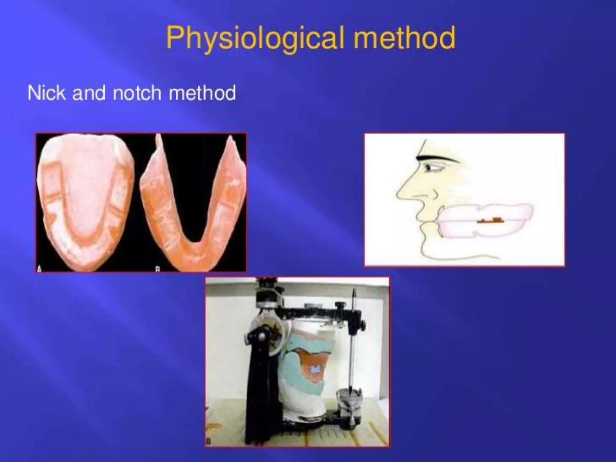 Horizontal jaw relation -prosthodontics | PPTX