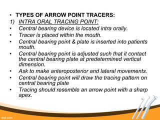 Horizontal jaw relation -prosthodontics | PPTX