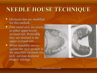 Horizontal jaw relations/dental courses | PPT