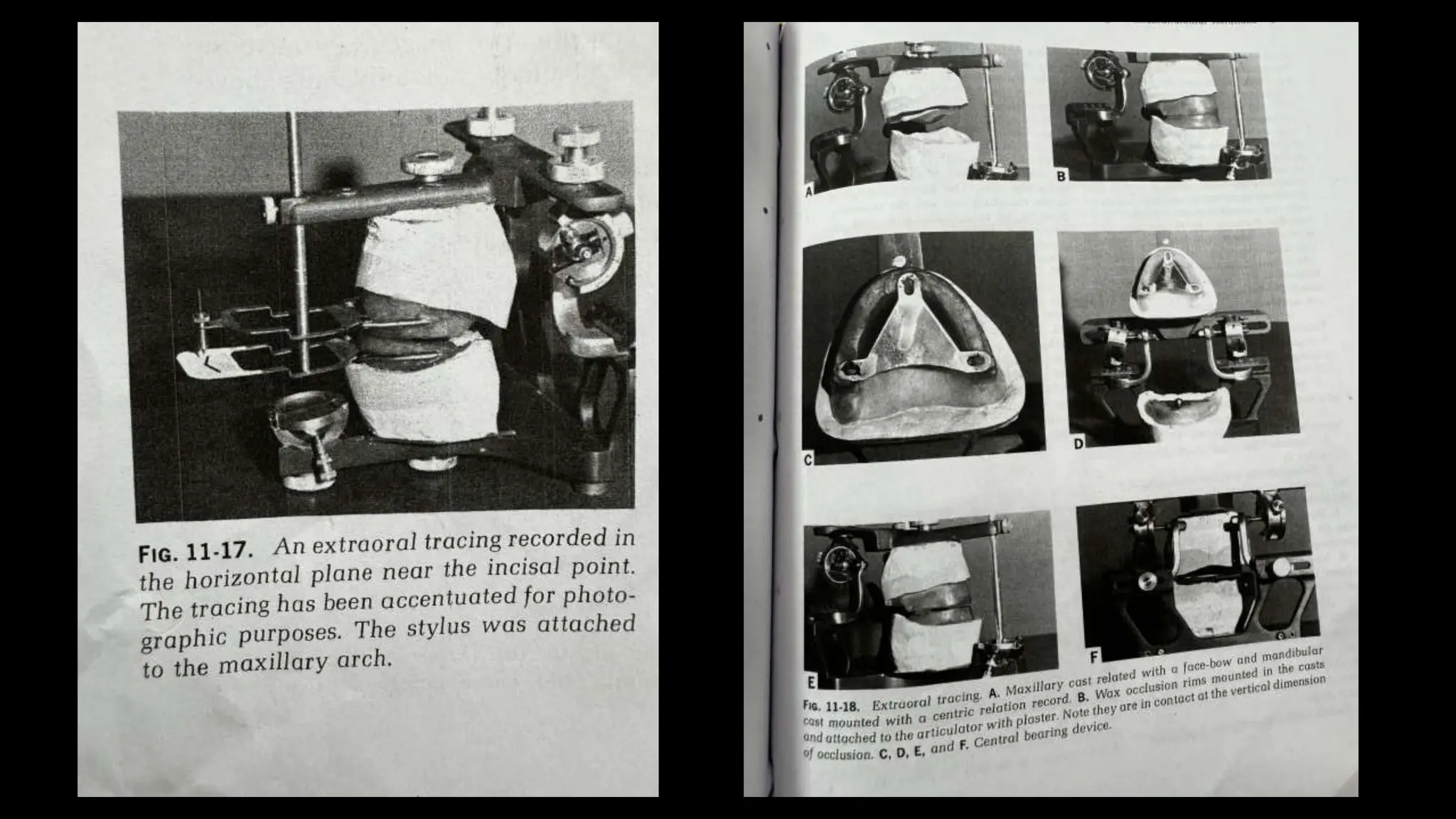 HORIZONTAL JAW RELATIONS - jaw relation pptx | PPTX