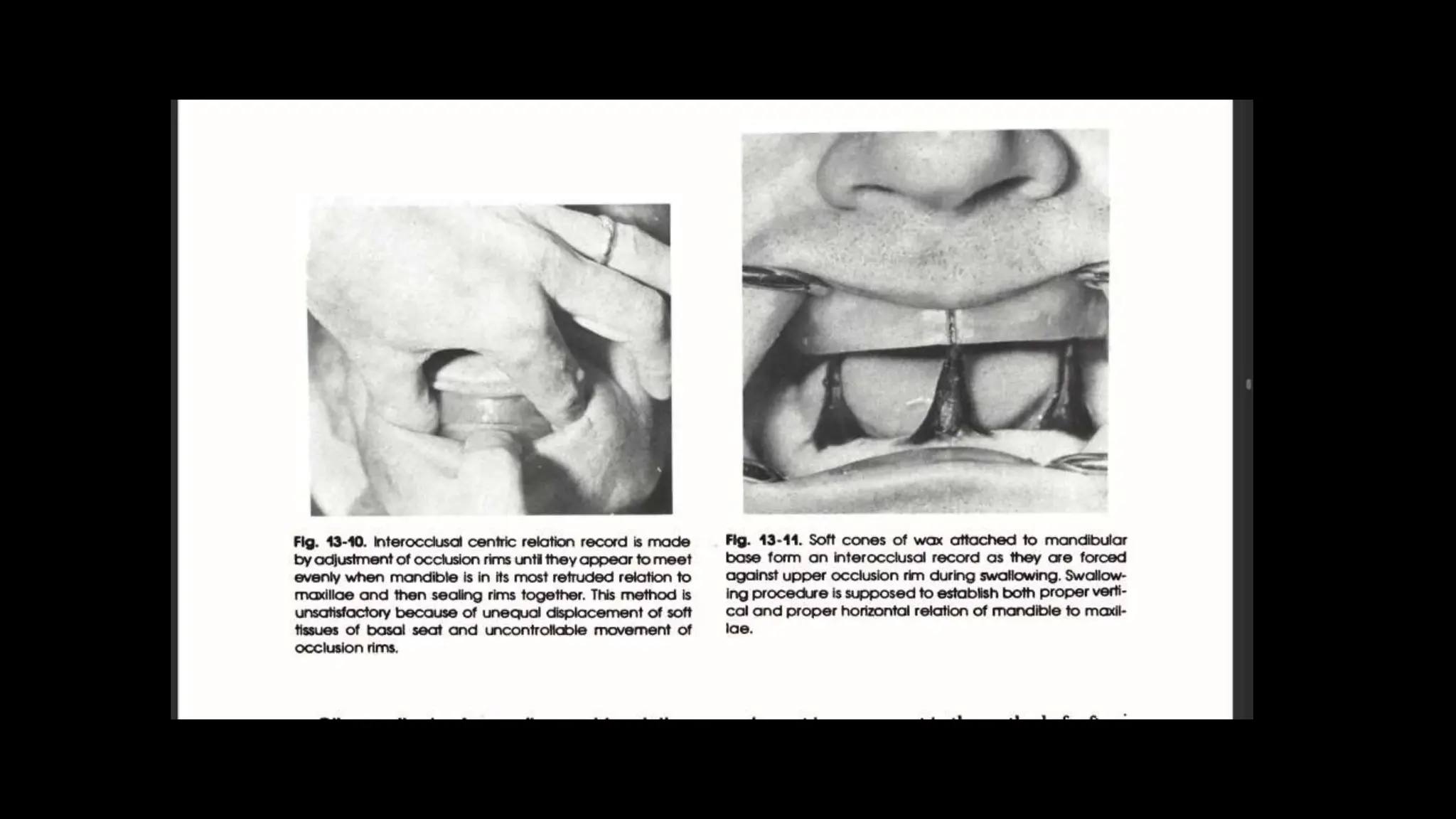 HORIZONTAL JAW RELATIONS - jaw relation pptx | PPTX