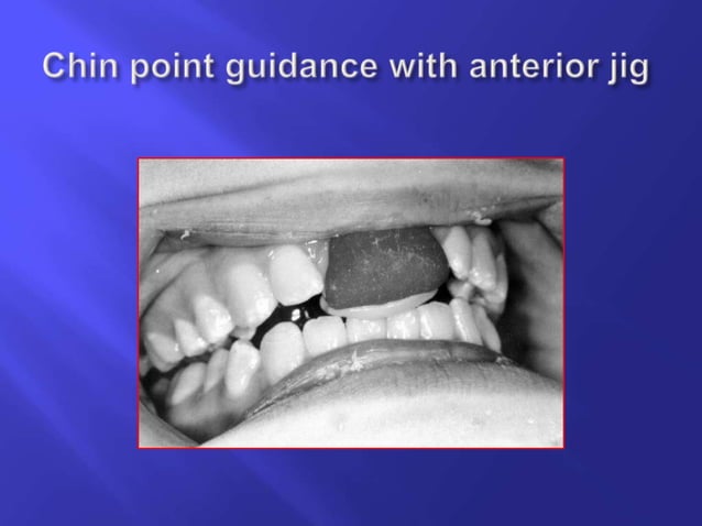 Horizontal jaw relations ppt | PPTX
