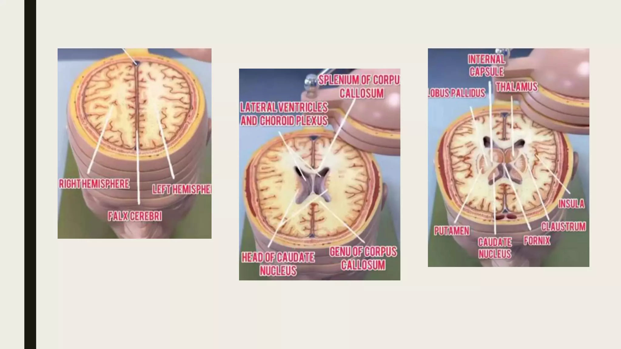 Horizontal section of brain.pptx