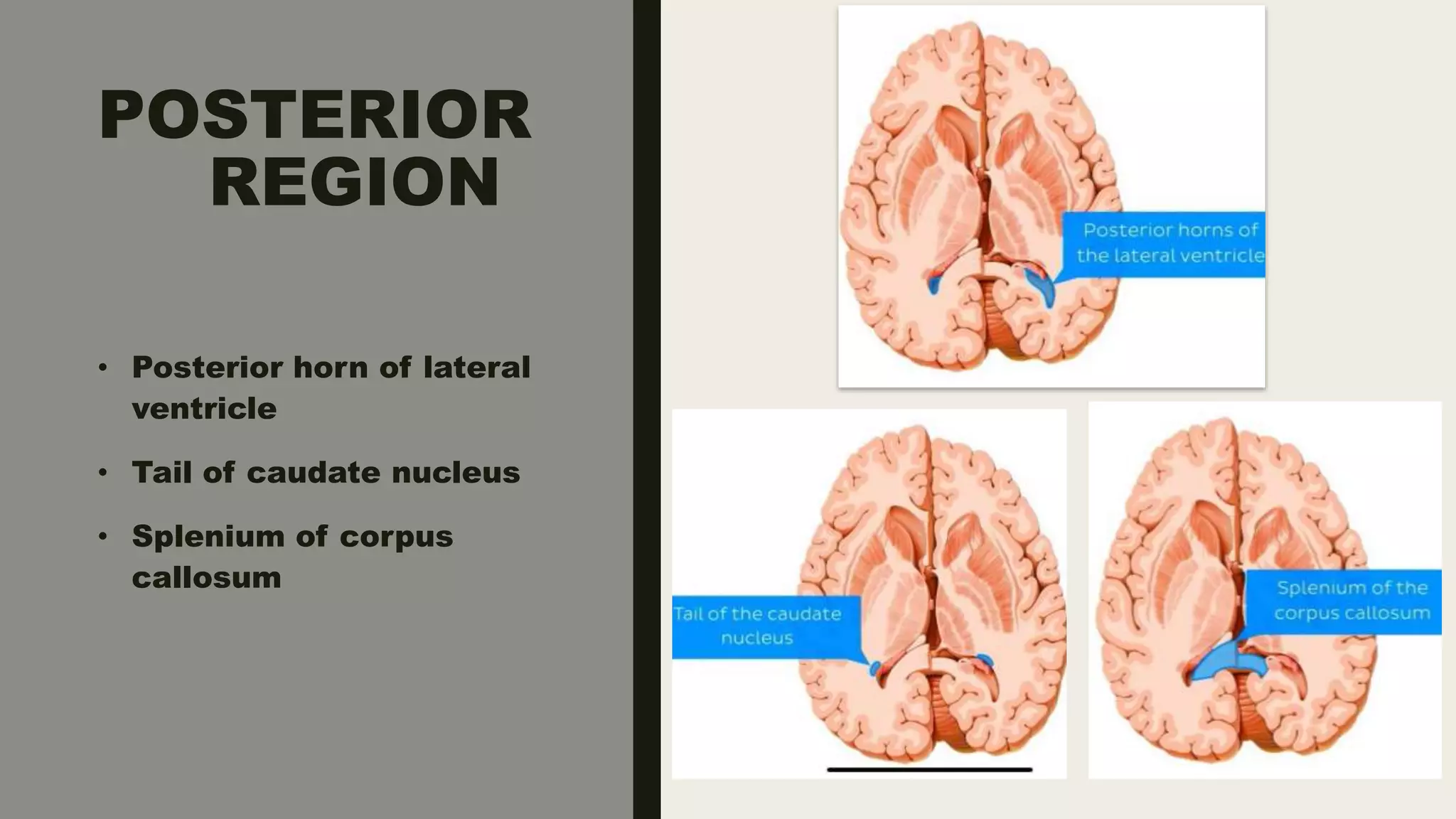 Horizontal section of brain.pptx