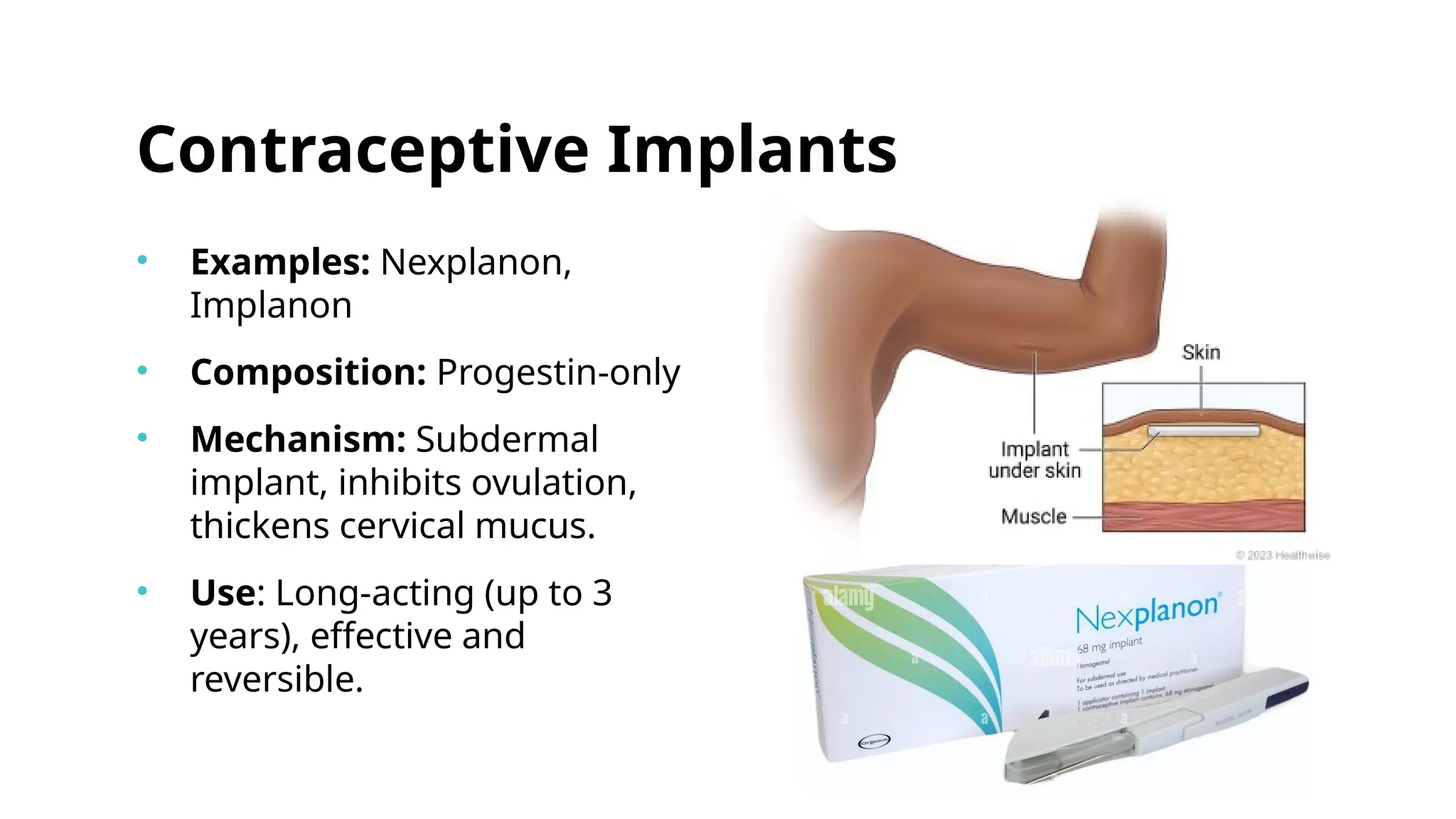 Hormonal Contraceptives: Types, Mechanisms, and Benefits | PPTX