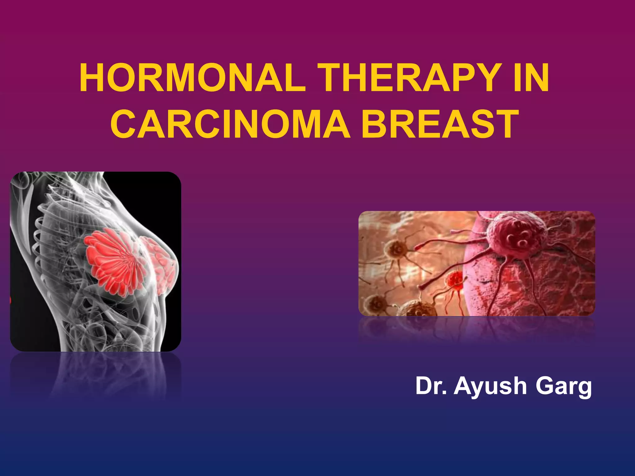 Hormonal therapy in breast cancer | PPT