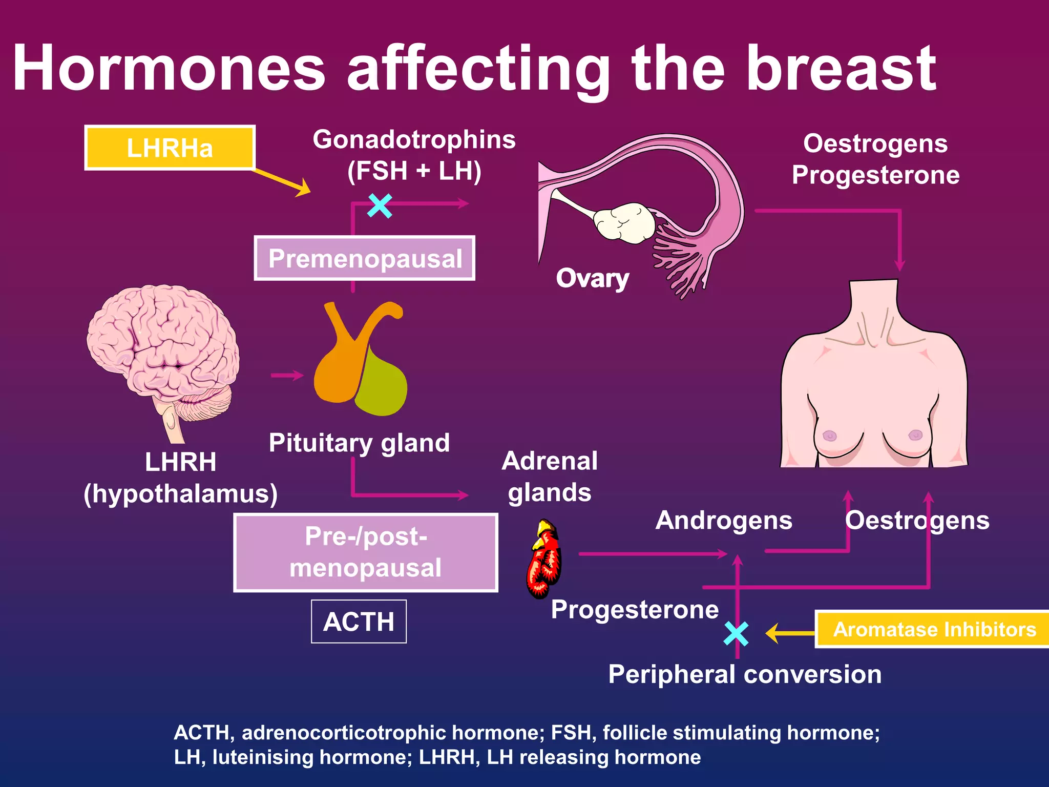 Hormonal therapy in breast cancer | PPT