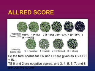 Hormonal therapy in breast cancer | PPT