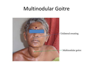 Anterior Pituitary hormones & Thyroid Hormones | PPT