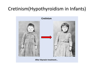 Anterior Pituitary hormones & Thyroid Hormones | PPT