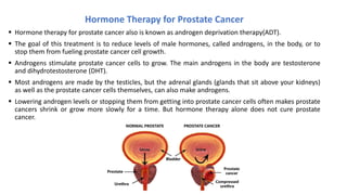 Prostate Cancer/ Medicinal Chemistry | PDF
