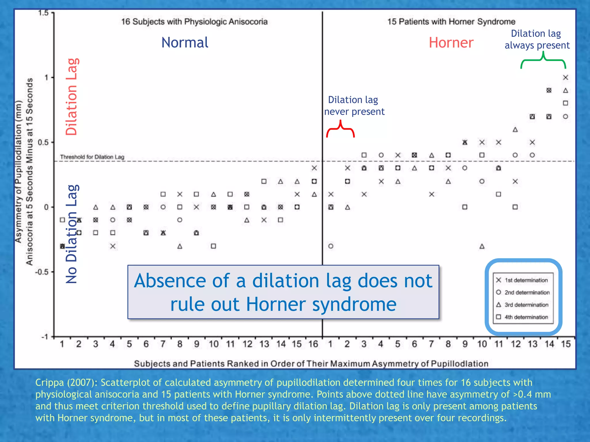 Horner Syndrome | PPTX