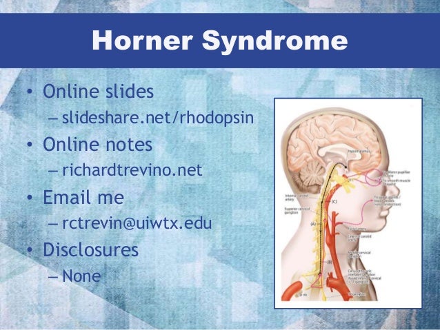 Horner Syndrome