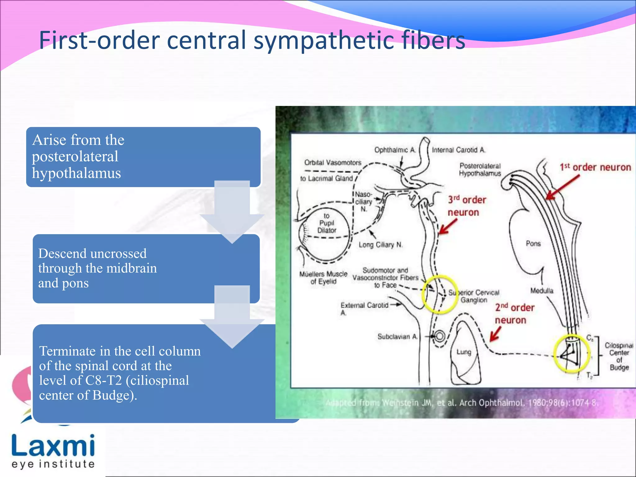 Horners syndrome | PPTX