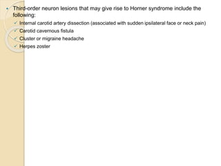Horner’s syndrome (in respect of sympathetic trunk injury) | PPT