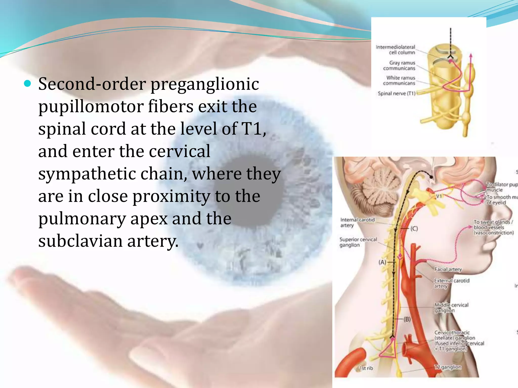 Horners syndrome | PPTX