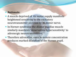 Horners syndrome | PPTX