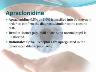Horners syndrome | PPTX