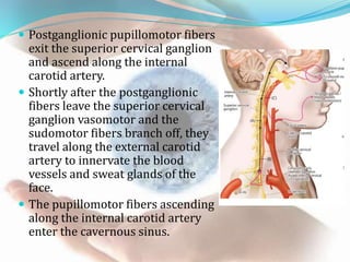 Horners syndrome | PPTX