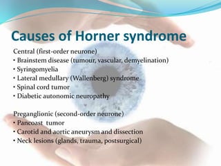 Horners syndrome | PPT
