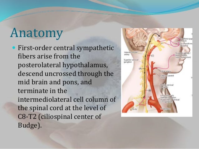 Horners syndrome