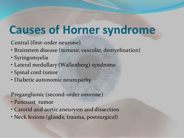 Horners syndrome
