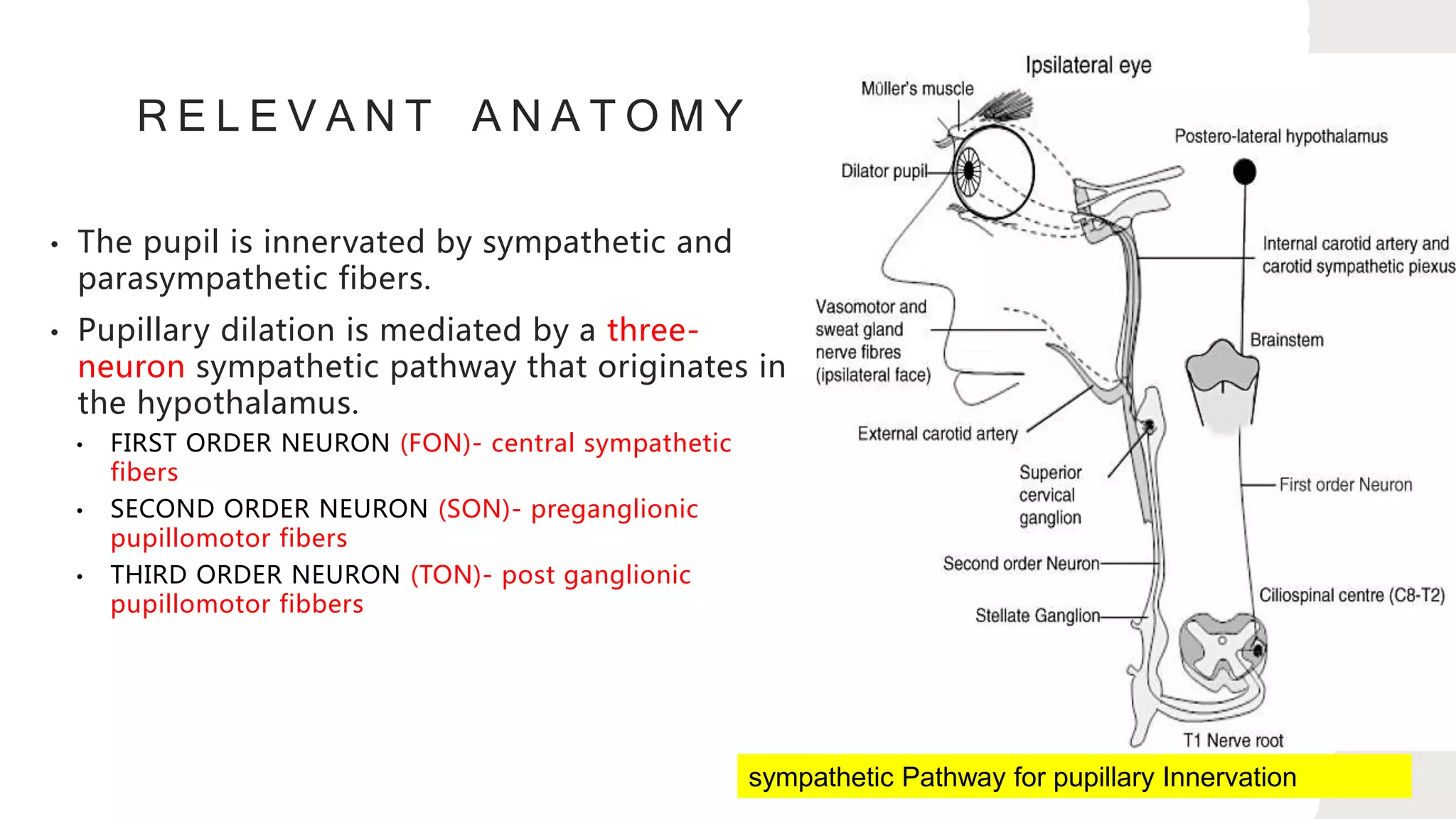 Horner's syndrome | PPTX