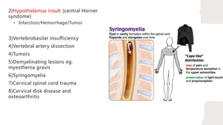 Horner's syndrome | PPTX