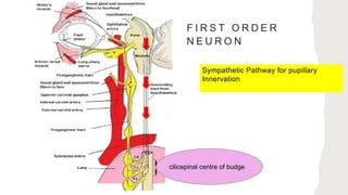 Horner's syndrome | PPTX
