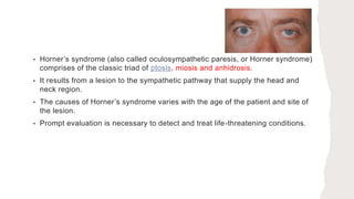 Horner's syndrome | PPT