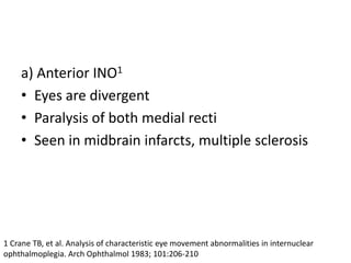 Horner's syndrome and Internuclear ophthalmoplegia | PPTX