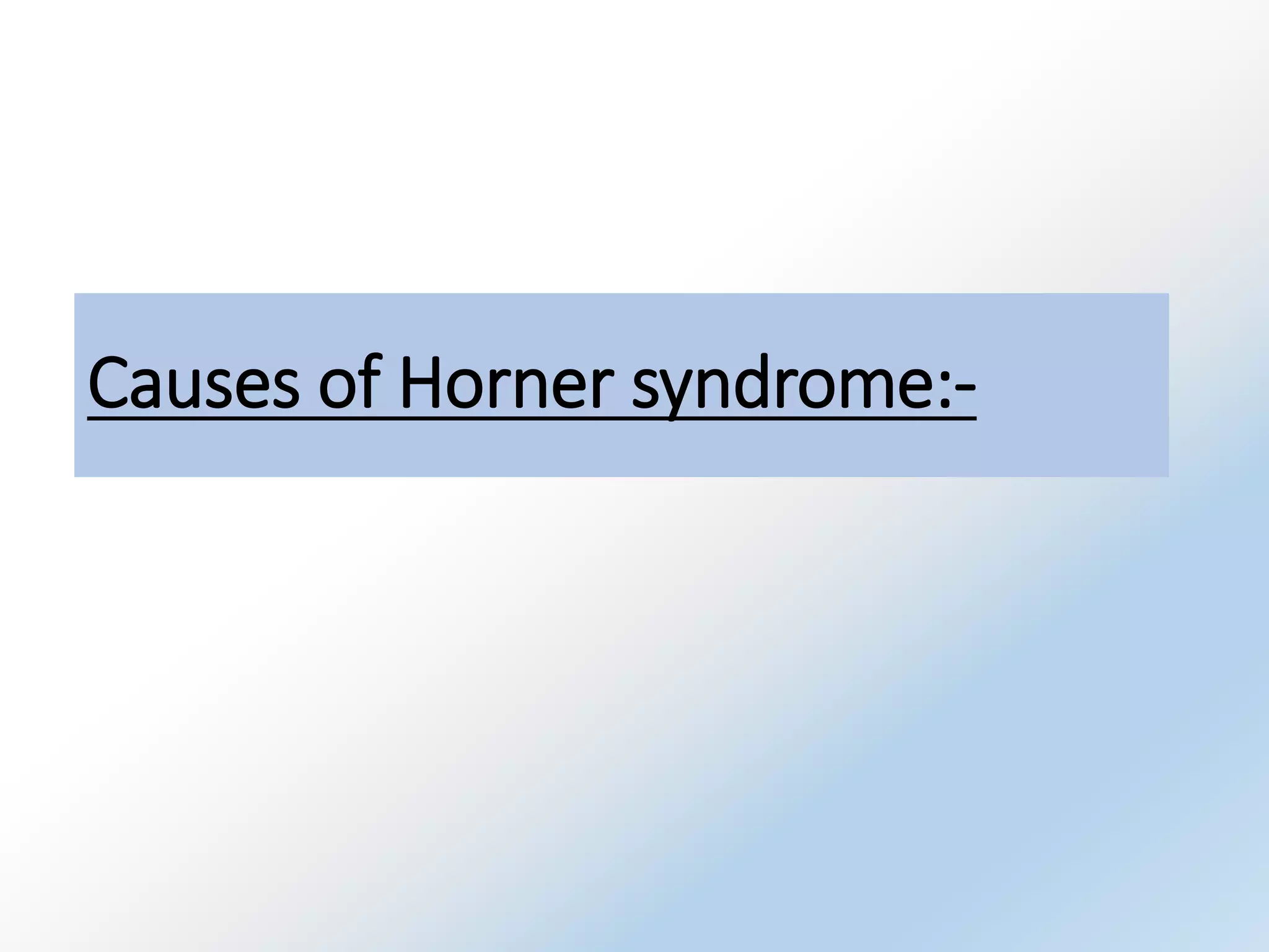 Horner syndrome. Horner's syndrome | PPTX | Eye and Vision Conditions ...
