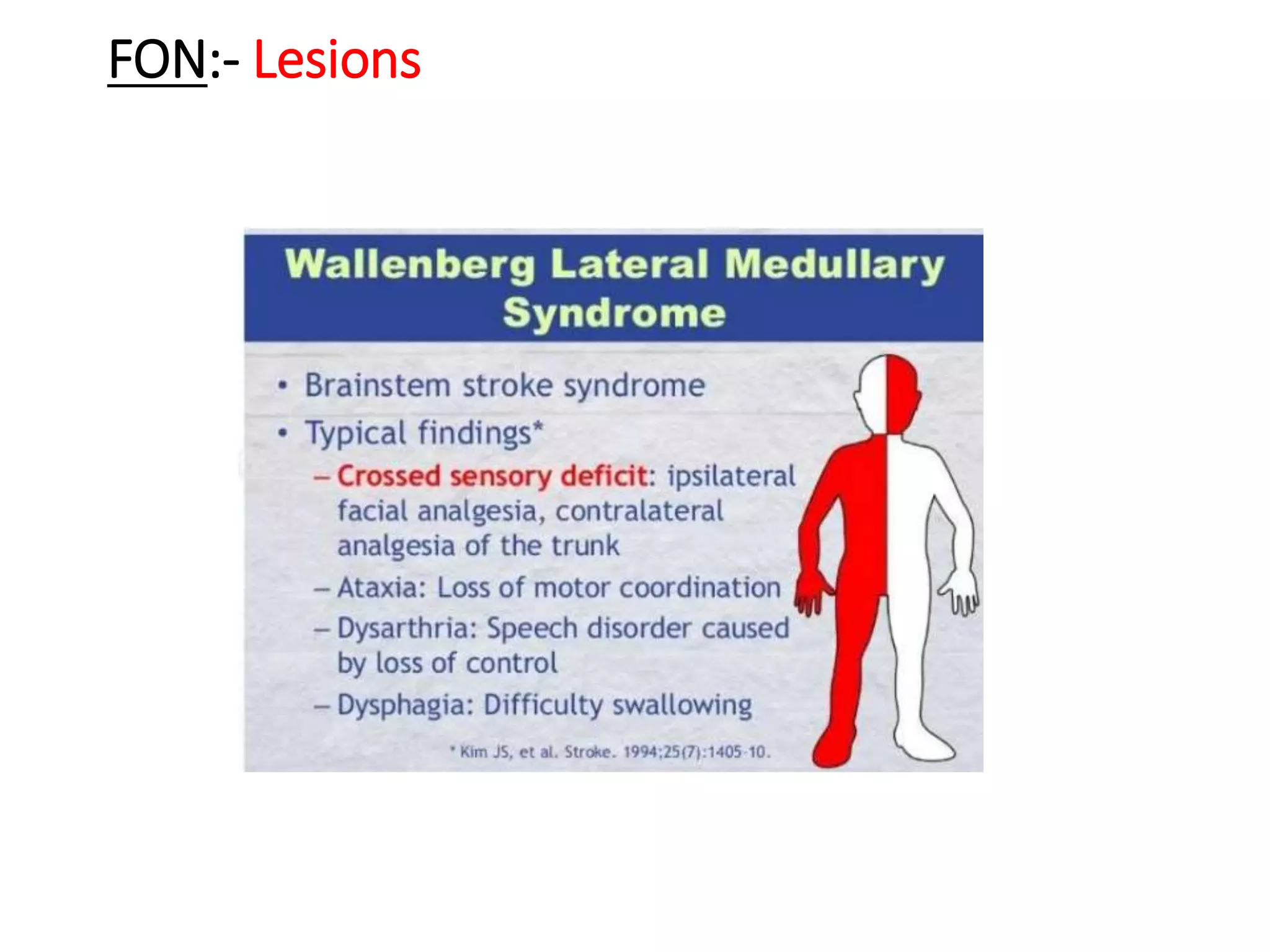 Horner syndrome. Horner's syndrome | PPTX