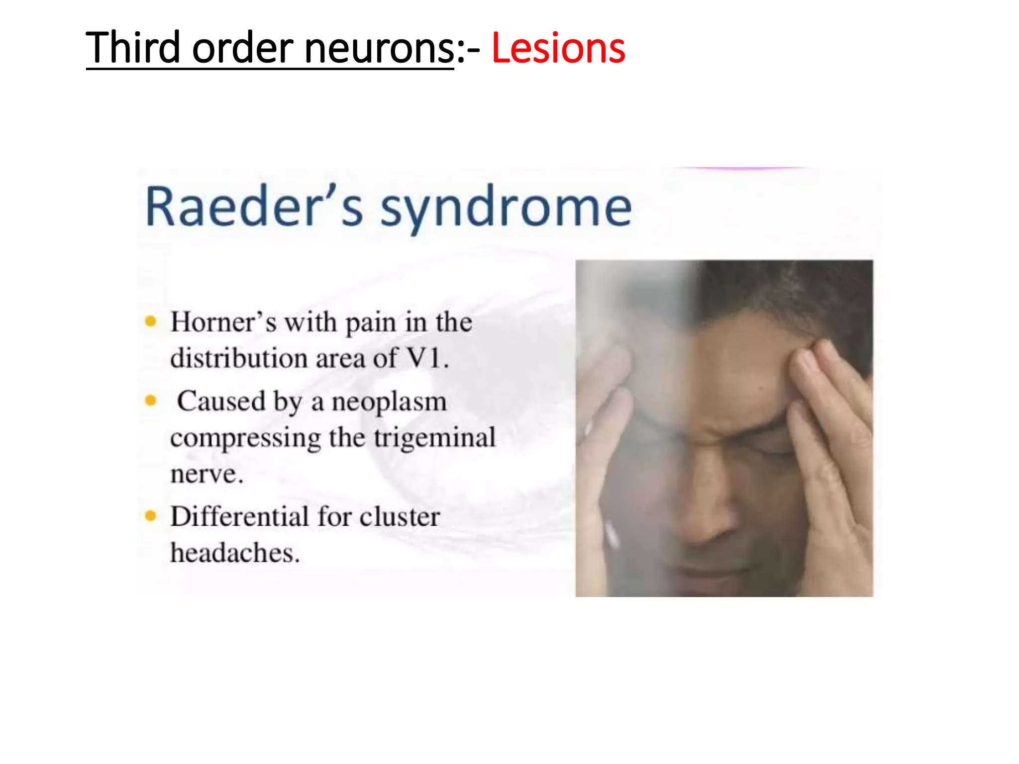 Horner syndrome. Horner's syndrome | PPTX