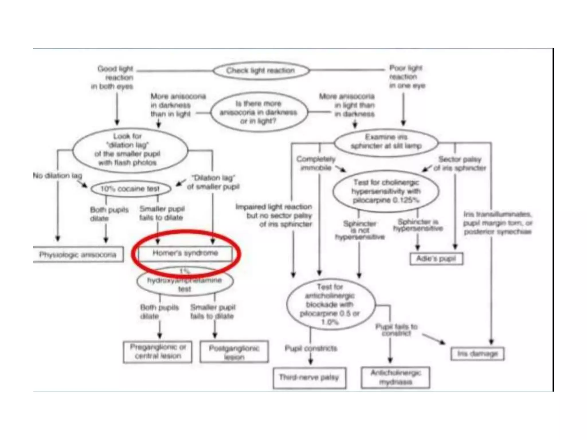 Horner syndrome. Horner's syndrome | PPTX