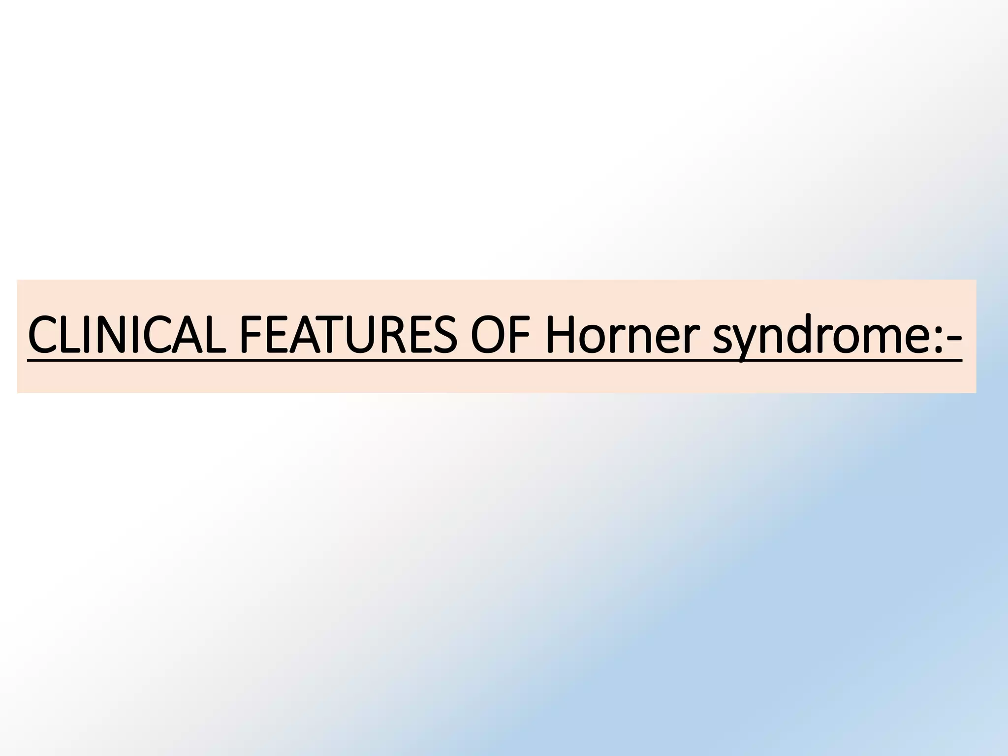 Horner syndrome. Horner's syndrome | PPTX