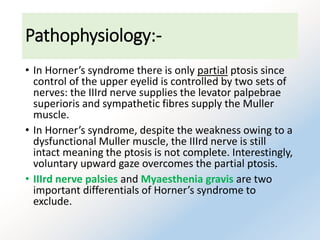 Horner syndrome. Horner's syndrome | PPTX